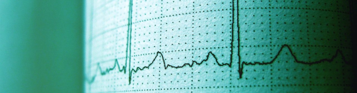 The Power of ECG: How Electrocardiograms Help Diagnose Heart Conditions ...