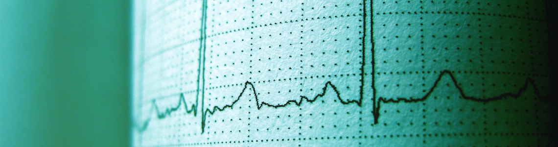 The Power of ECG: How Electrocardiograms Help Diagnose Heart Conditions ...