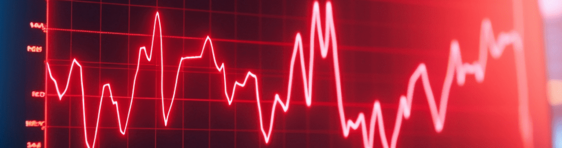 What Is Electrophysiology and How Does It Impact Your Heart? – TEXAS ...